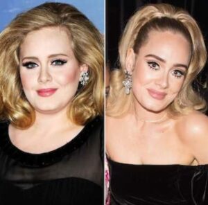 Did Adele Get Plastic Surgery? Her Transformation Explained