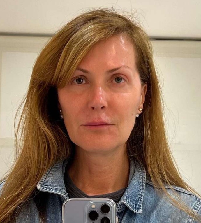 Is Dagen Mcdowell Sick? What Happened to Dagen Mcdowell?