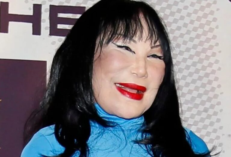 What Happened to Lyn May Face? Has Lyn May Had Plastic Surgery?